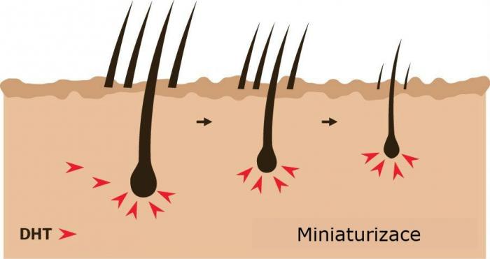 DHT blokátory i pro ženy? | eOtazky.cz