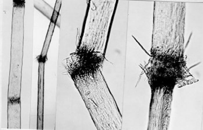 Trichonodosis | eOtazky.cz